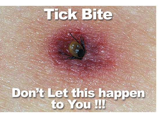 Ticks are Exploding right now in the Spring all over Eastern Long ...